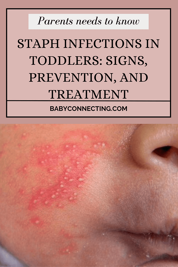 Staph Infections in Toddlers: Signs, Prevention, and Treatment ...