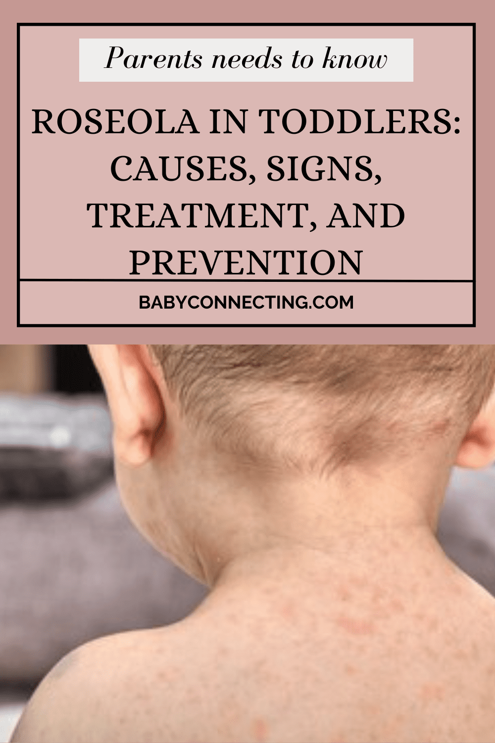 Roseola in Toddlers: Causes, Signs, Treatment, and Prevention ...